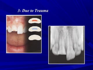 Conventional RCT | PPT