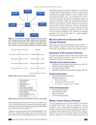 conventional_to_minimally_invasive_root_coverage.1.pdf