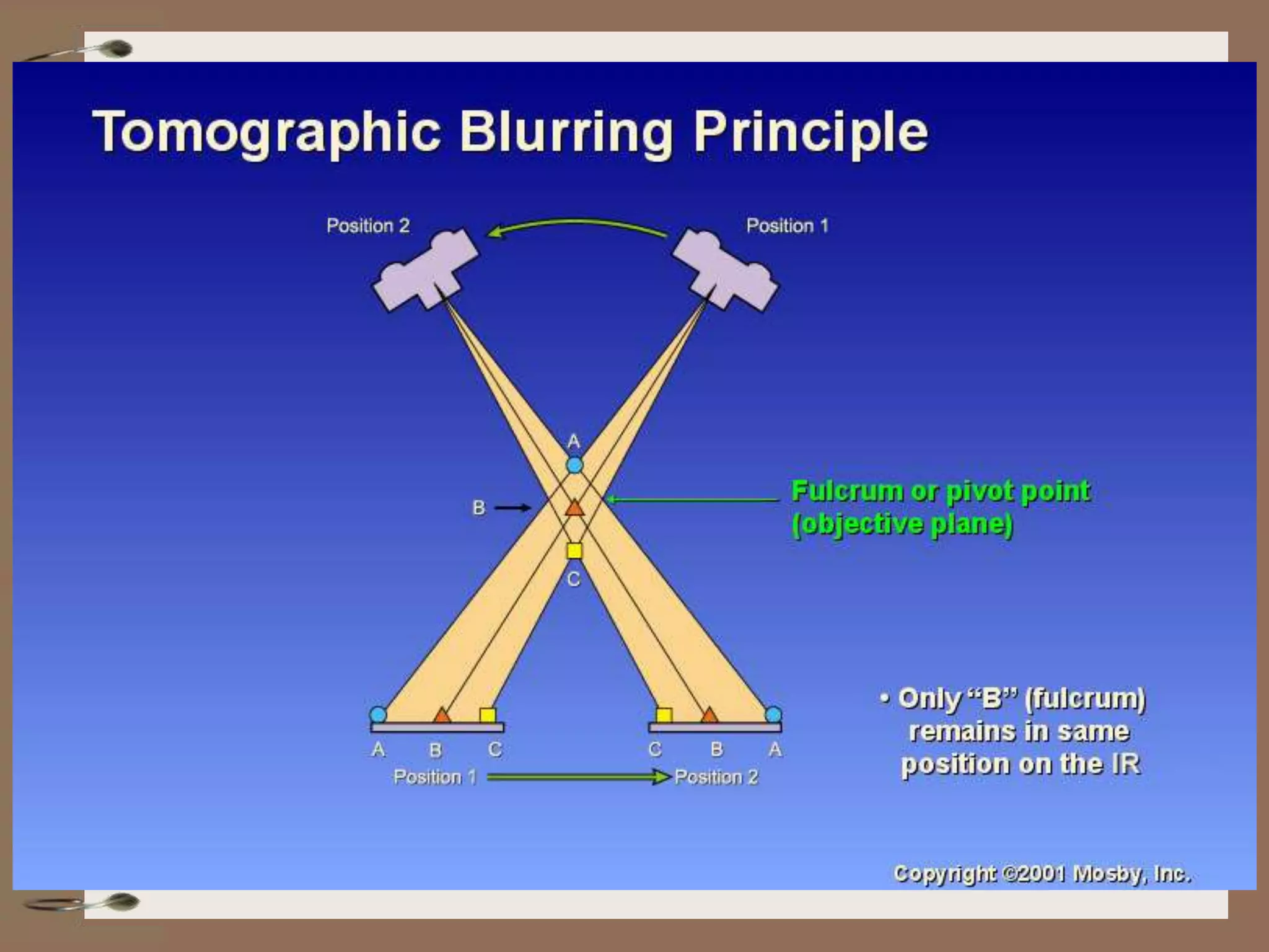CONVENTIONAL TOMOGRAPHY.ppt