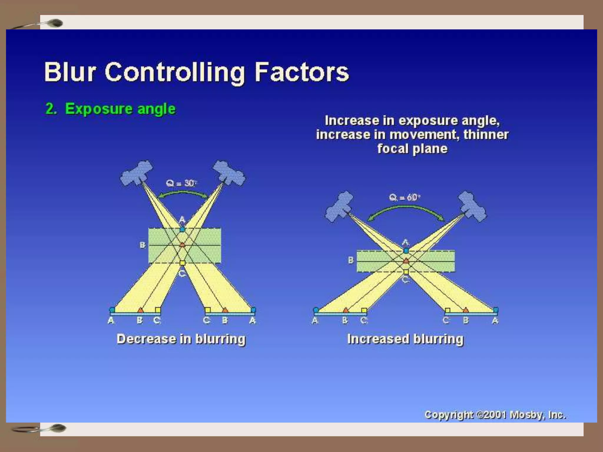 CONVENTIONAL TOMOGRAPHY.ppt