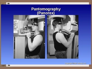 CONVENTIONAL TOMOGRAPHY.ppt