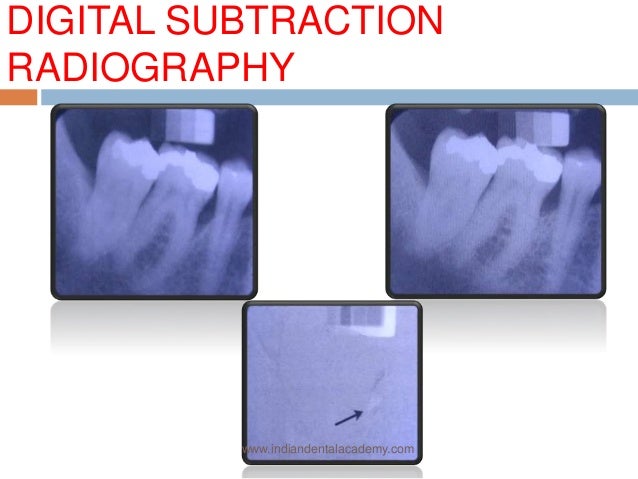 Conventional versus digital/ dental implant courses