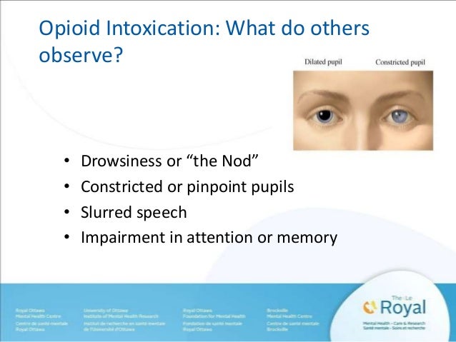 Getting the low down on prescription opioids: Learn how to notice the…