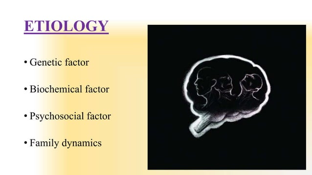Conversion disorder | PPTX