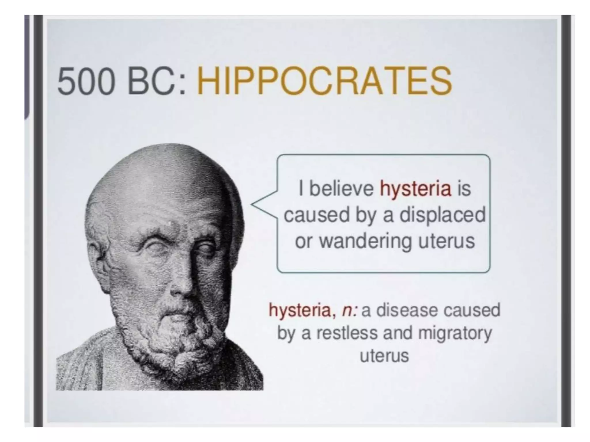 Conversion hysteria | PPTX