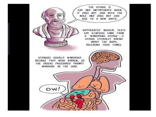 Conversion hysteria | PPTX