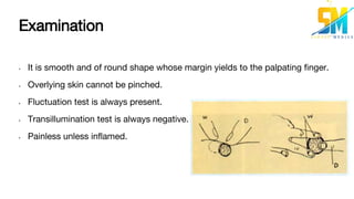 sebaceous cyst | PPT
