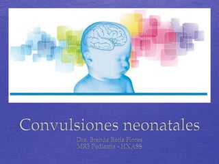 Convulsión neonatal.pptx