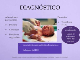 Convulsión neonatal.pptx