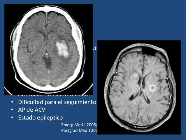Convulsiones en el servicio de urgencias
