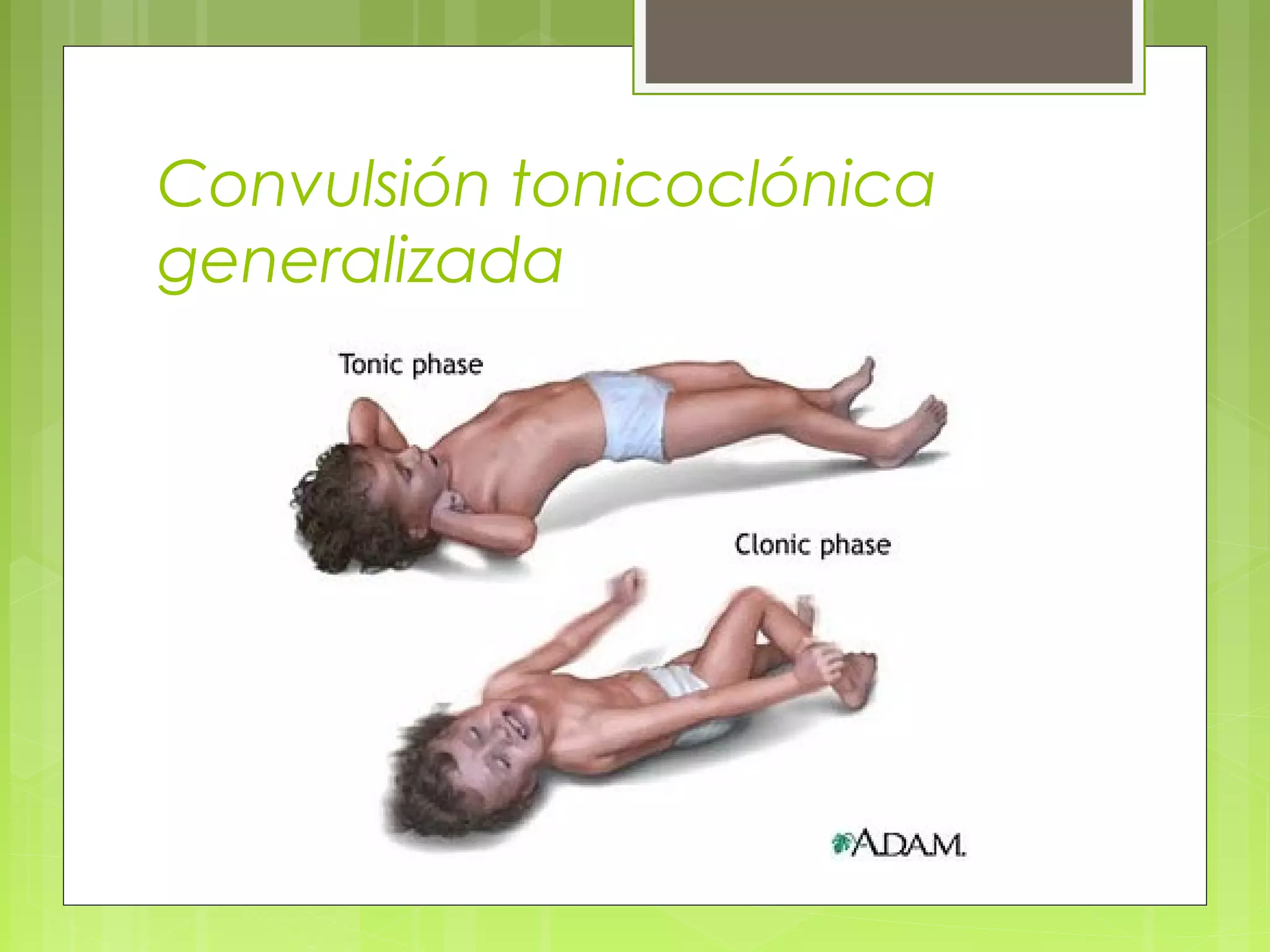 Convulsiones en pediatria | PPT