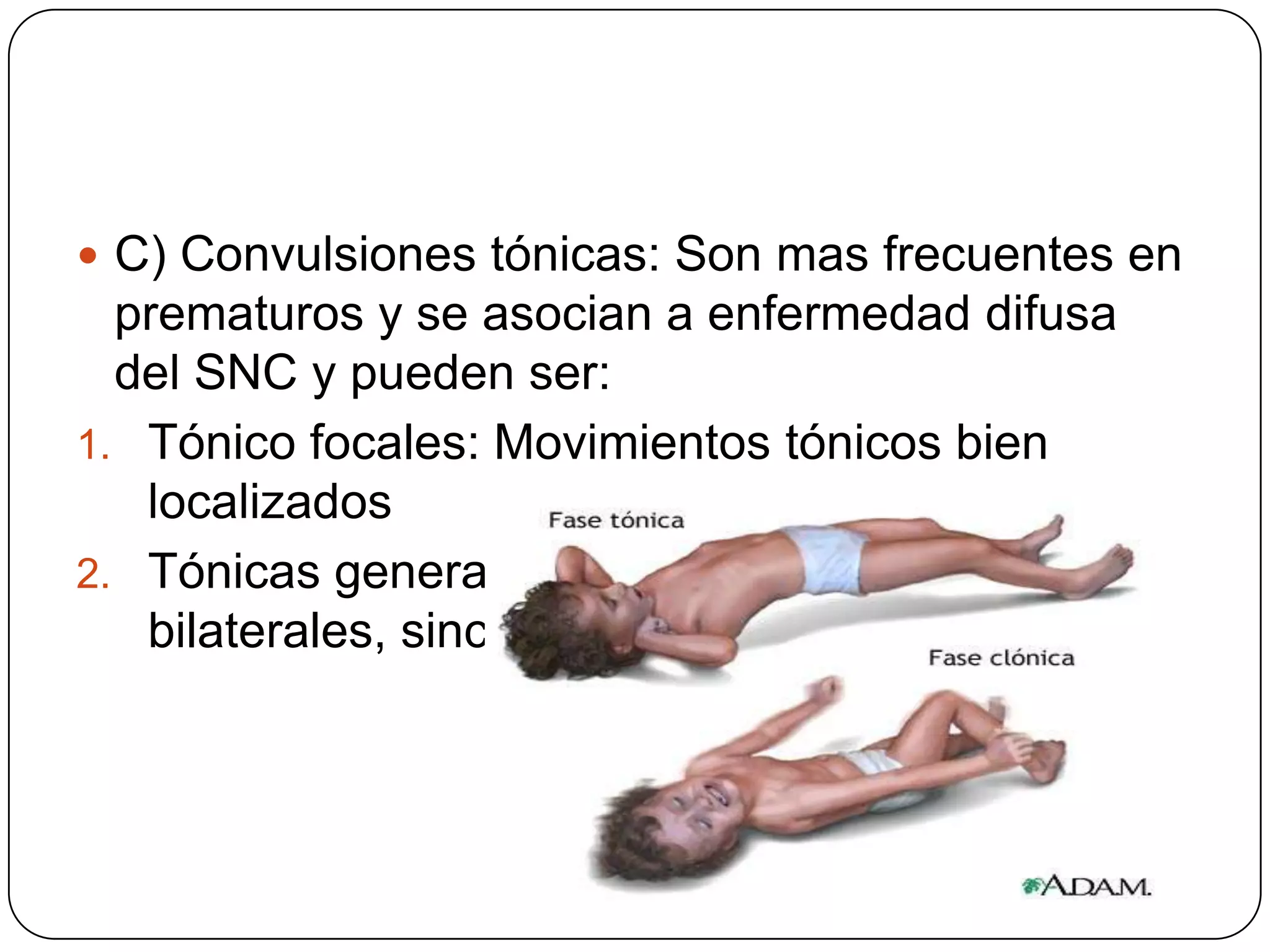 Convulsiones neonatales dr. artiaga | PPTX