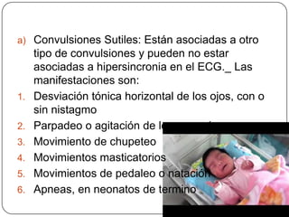 Convulsiones neonatales dr. artiaga | PPTX