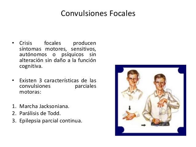Convulsiones y epilepsia