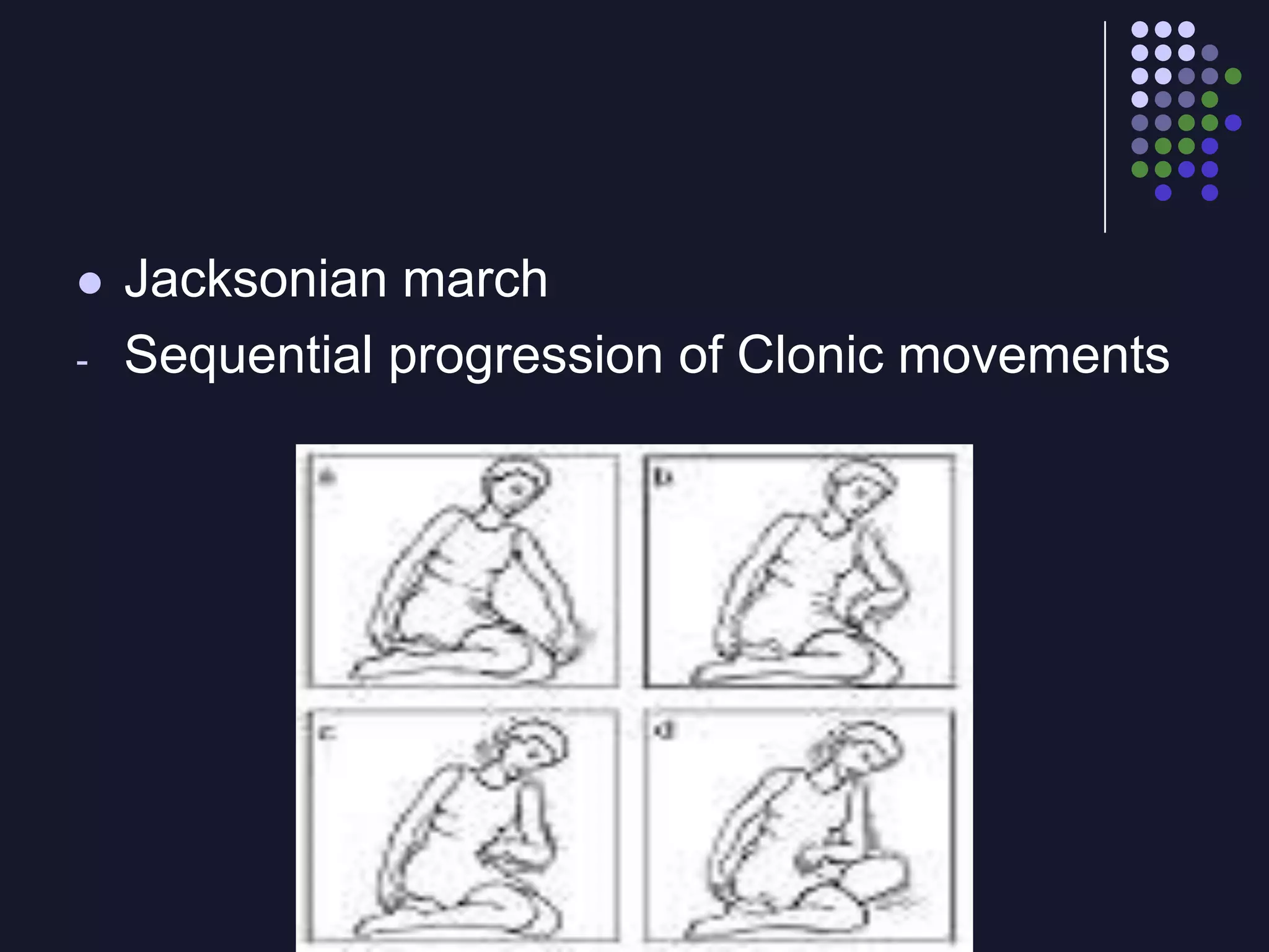 pediatric convulsion | PPT
