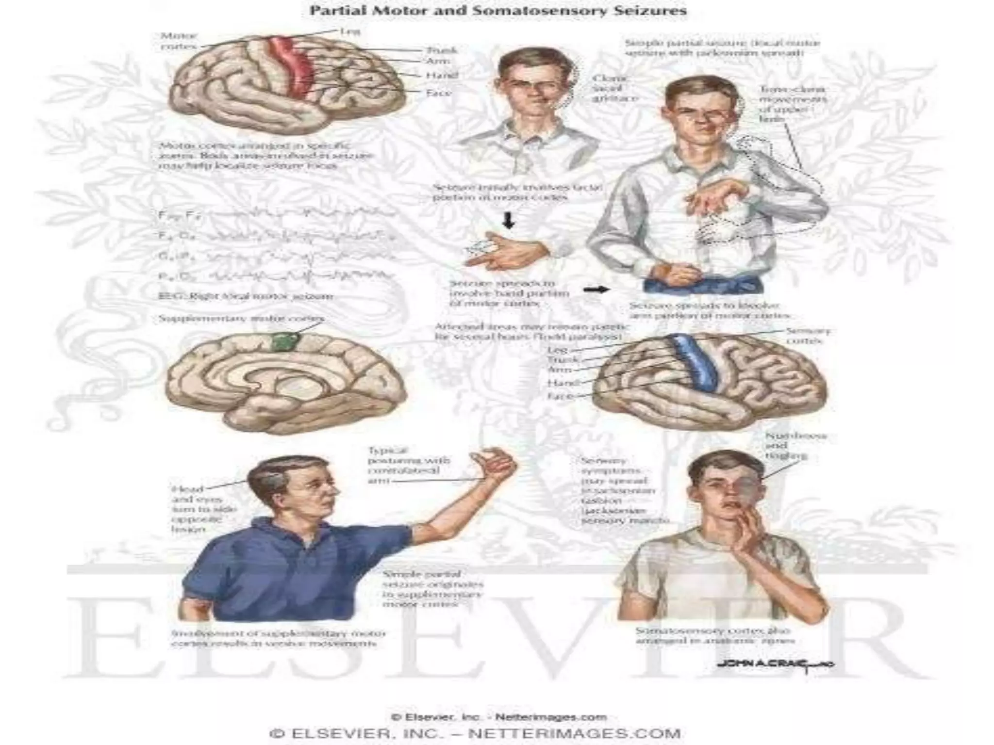 pediatric convulsion | PPTX