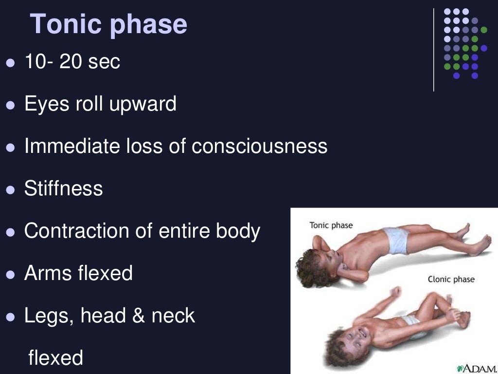 pediatric convulsion
