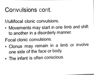 convulsions in neonates management and treatment | PDF