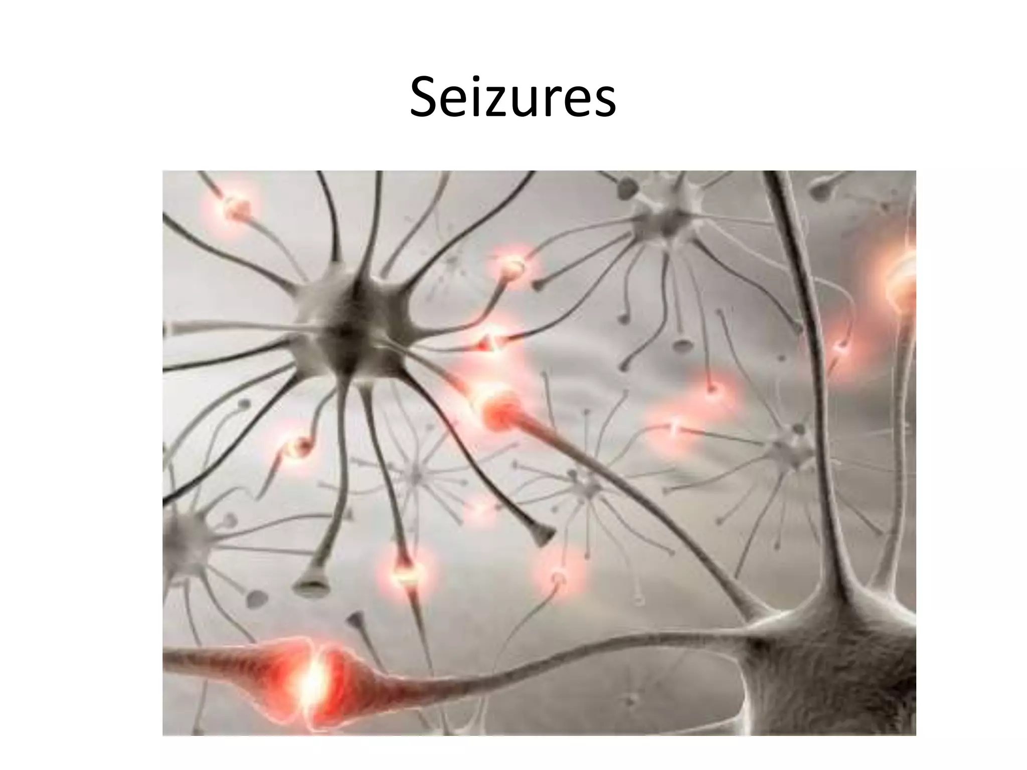 CONVULSIONS (SEIZURES).ppt