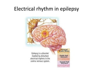 CONVULSIONS (SEIZURES).ppt