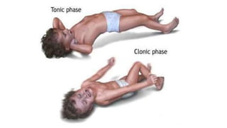 Convulsive disorder | PPTX