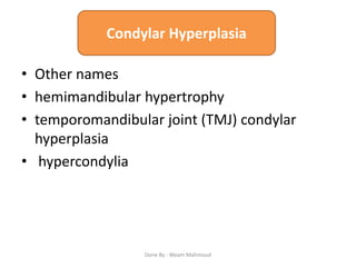 Conylar hyperplasia | PPSX
