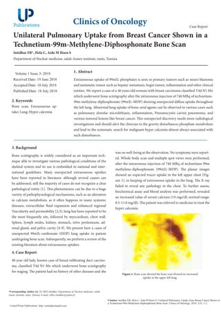 Unilateral Pulmonary Uptake from Breast Cancer Shown in a Technetium ...