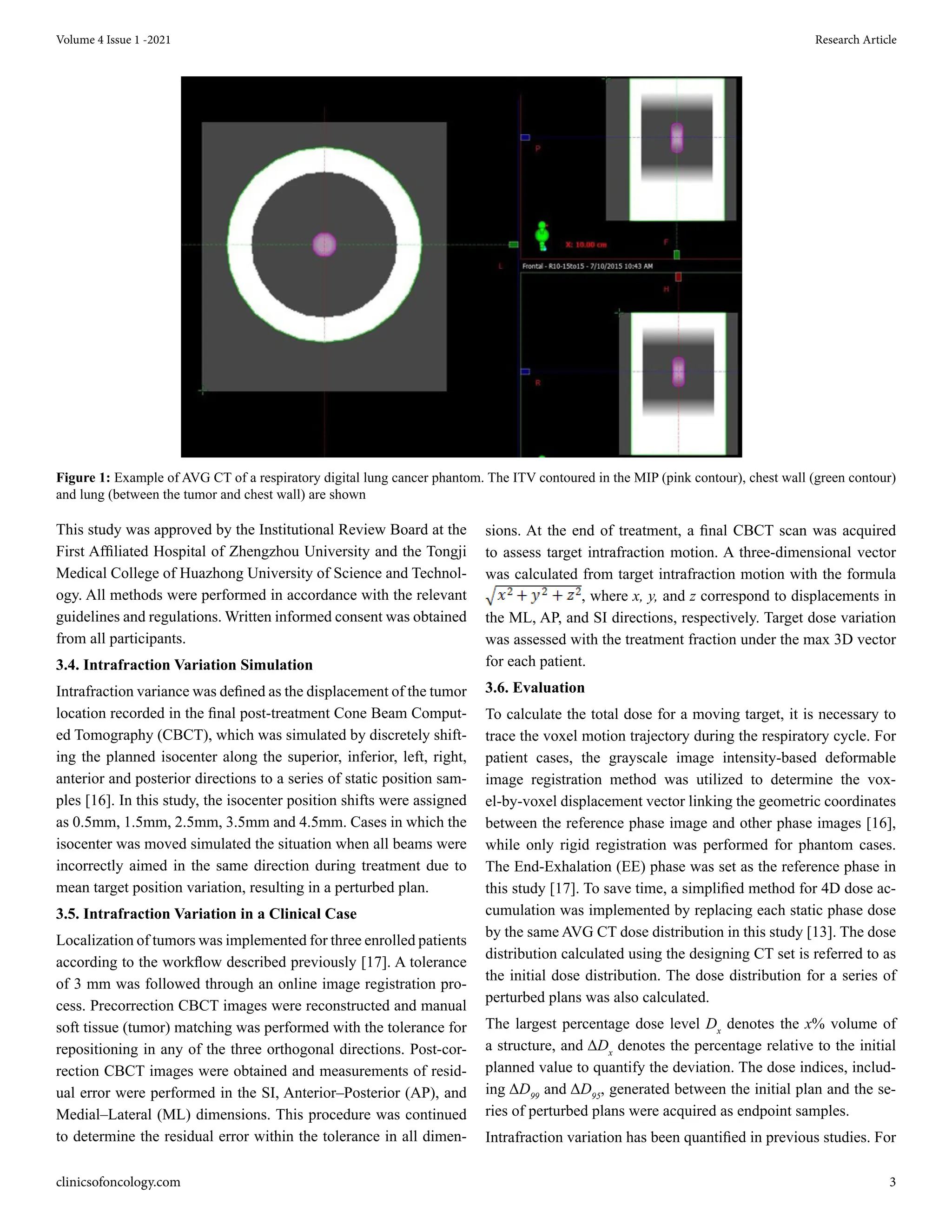 Dosimetric Consequences of Intrafraction Variation of Tumor Motion in Lung Stereotactic Body ...