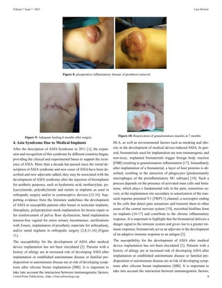 Asia Syndrome and Breast Implants, Report of A Case and Review of the ...
