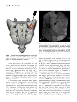 Cooled radiof 2008 | PDF