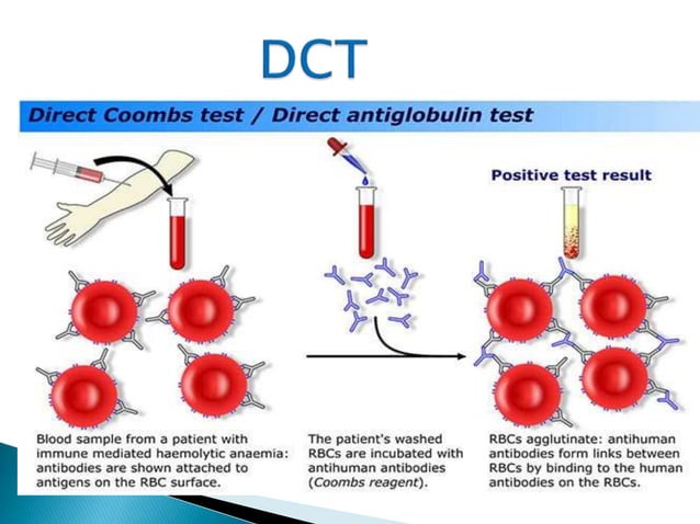 Coomb's test | PPTX | Blood Disorders | Diseases and Conditions