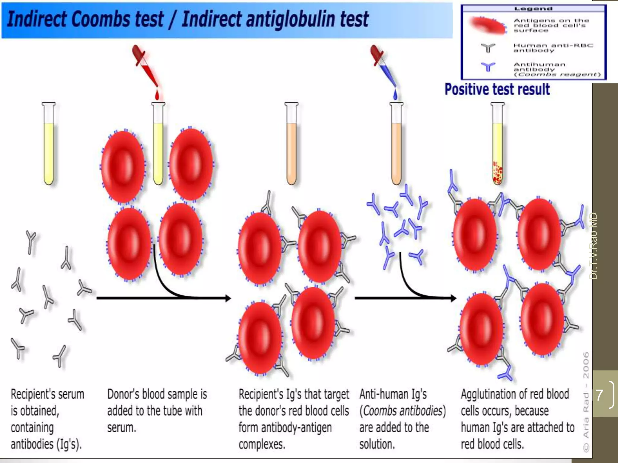 COOMBS TEST.ppt