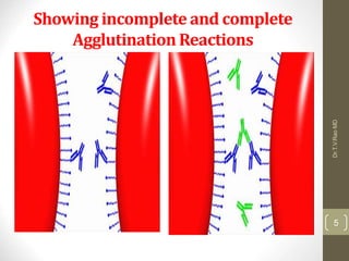 COOMBS TEST.ppt