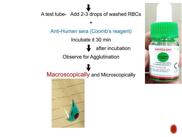 COOMB'S TEST.pptx