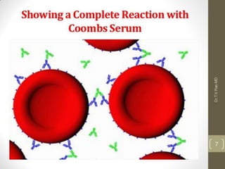 Coombs test and eliza | PPT