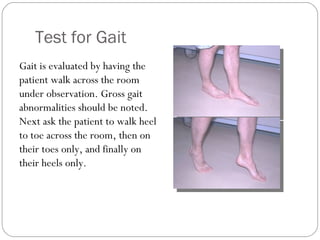 Tandem Gait Test