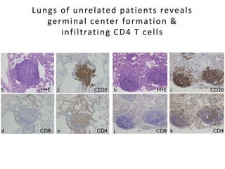COPA mutations impair Golgi-ER transport causing hereditary autoimmune ...