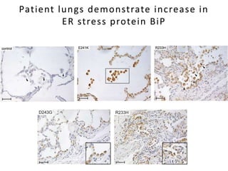 COPA mutations impair Golgi-ER transport causing hereditary autoimmune ...