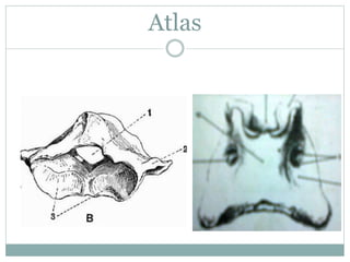 Comparative study of vertebral column of camel, ox and horse | PPTX