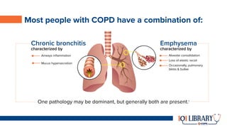 COPD 101 (full) This PPT version of COPD 101 | PDF