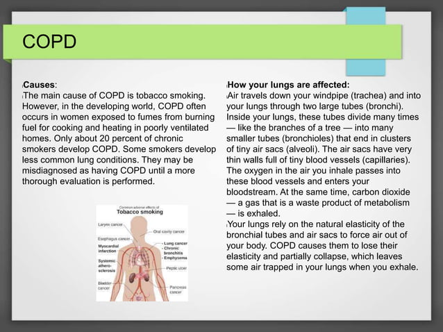 Copd | PPTX