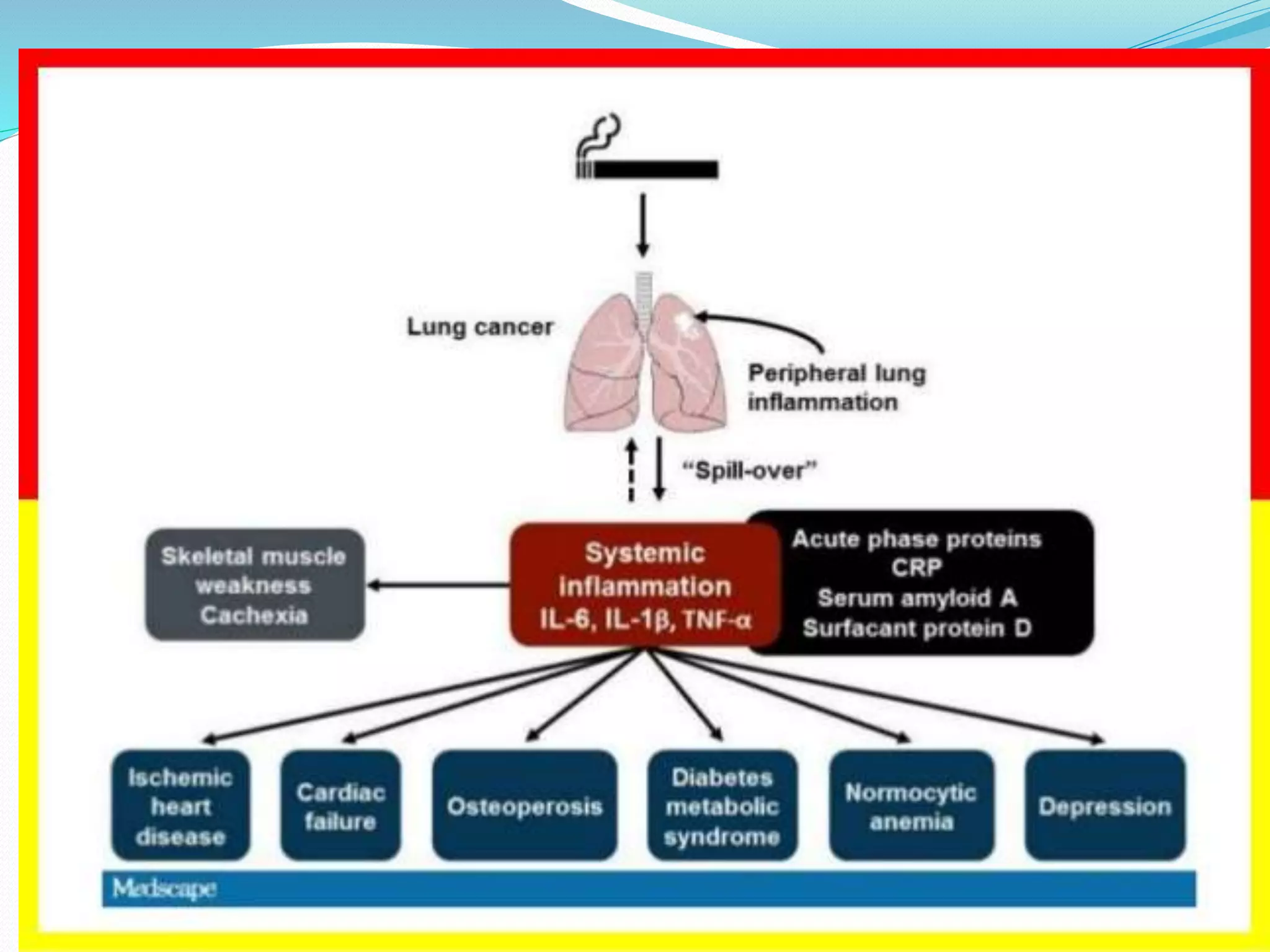 COPD systemic effects and comorbidities | PPTX