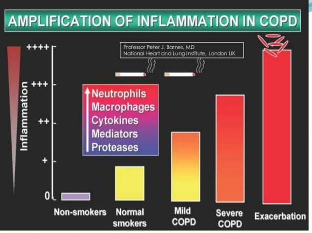 COPD systemic effects and comorbidities | PPT