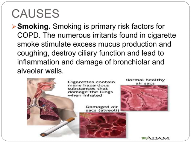 Copd | PPTX | Lung and Respiratory Health | Diseases and Conditions