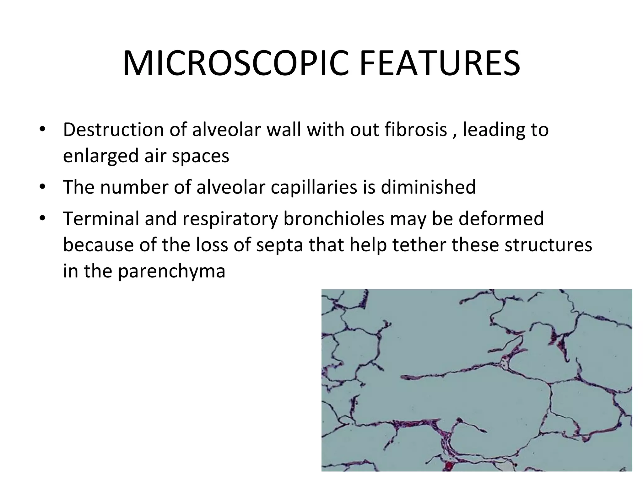 COPD | PPT