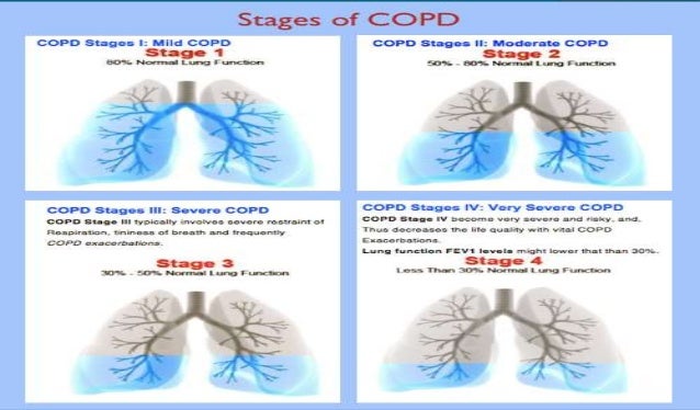 Copd