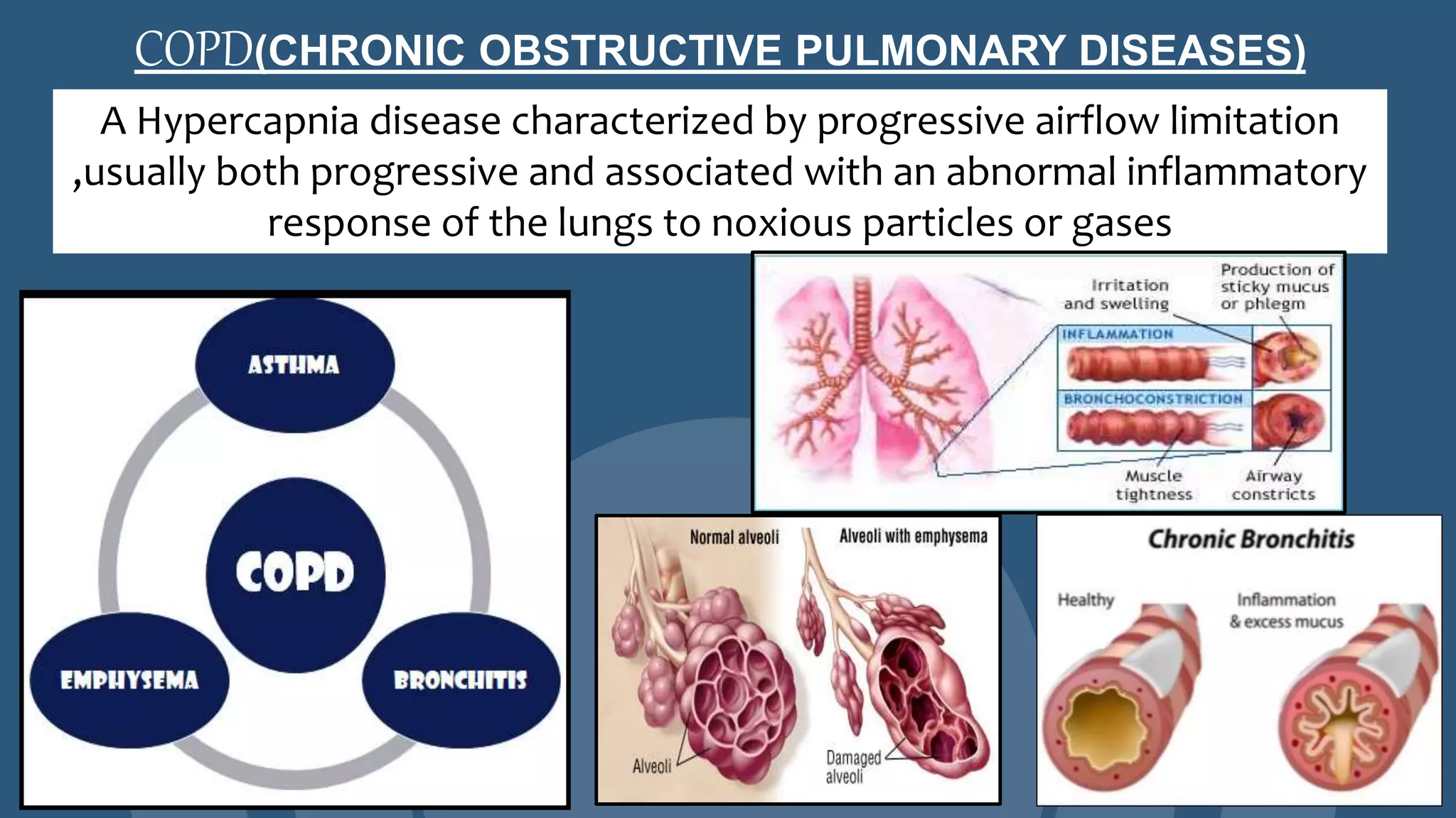 Copd | PPT
