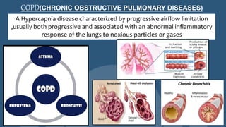 Copd | PPTX