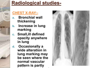 COPD | PPTX
