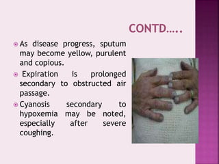 Copd | PPTX